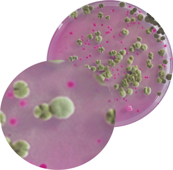 SYMPHONY Agar | Bioneks®